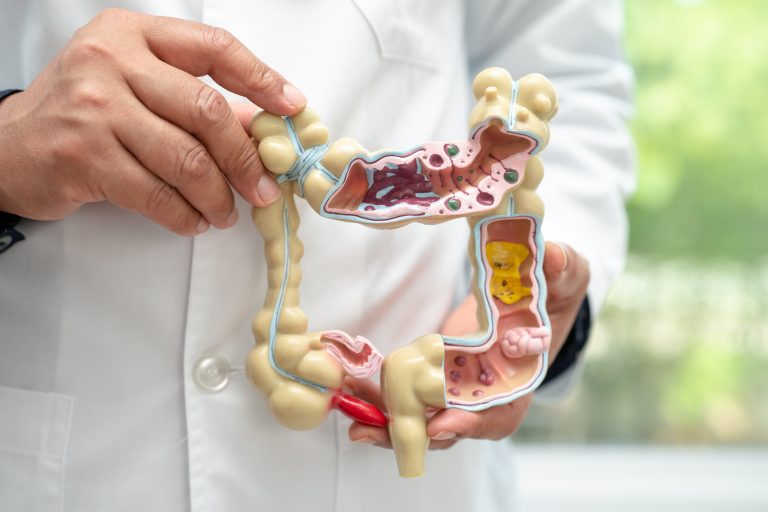 Operación de cáncer de colon: pasos, técnicas y recuperación